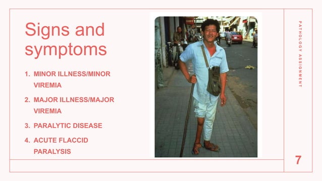 poliomyelitis pathology, causes, risk factors | PPT