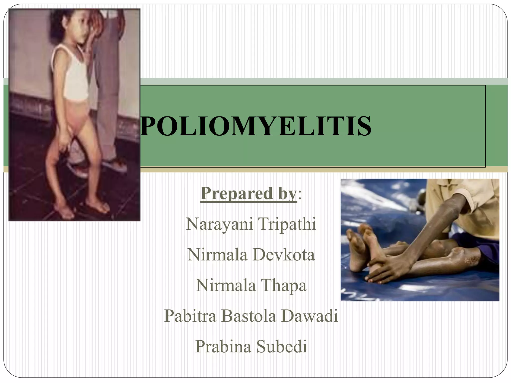 Poliomyelitis uploaded by Samrat Gurung | PPTX