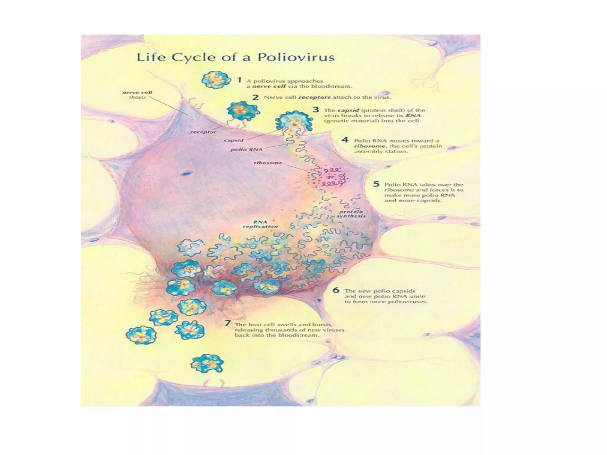 poliomylitis.pdf