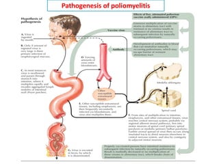 poliomylitis.pdf