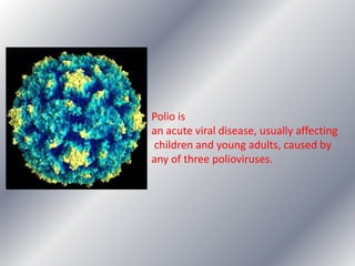 Polio power point | PPTX