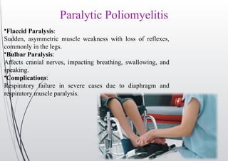 Polio presentation with Structure , Types and Treatment | PPTX