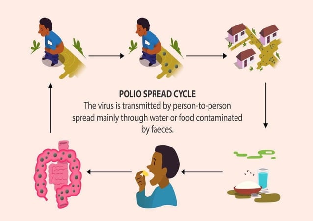 Polio presentation with Structure , Types and Treatment | PPT