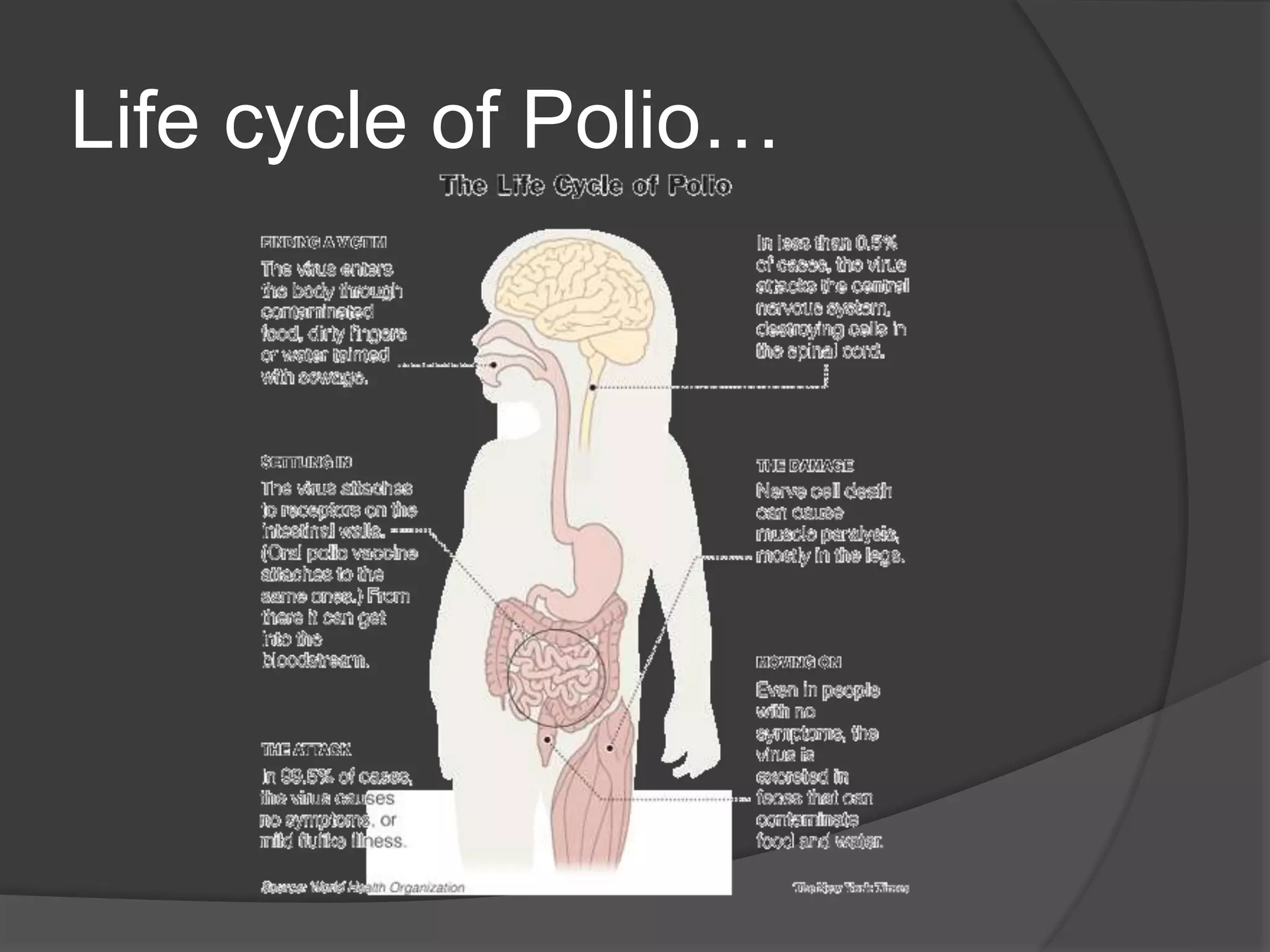 Polio project | PPSX
