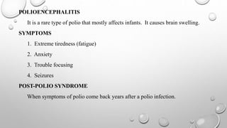 Polio seminar.pptx