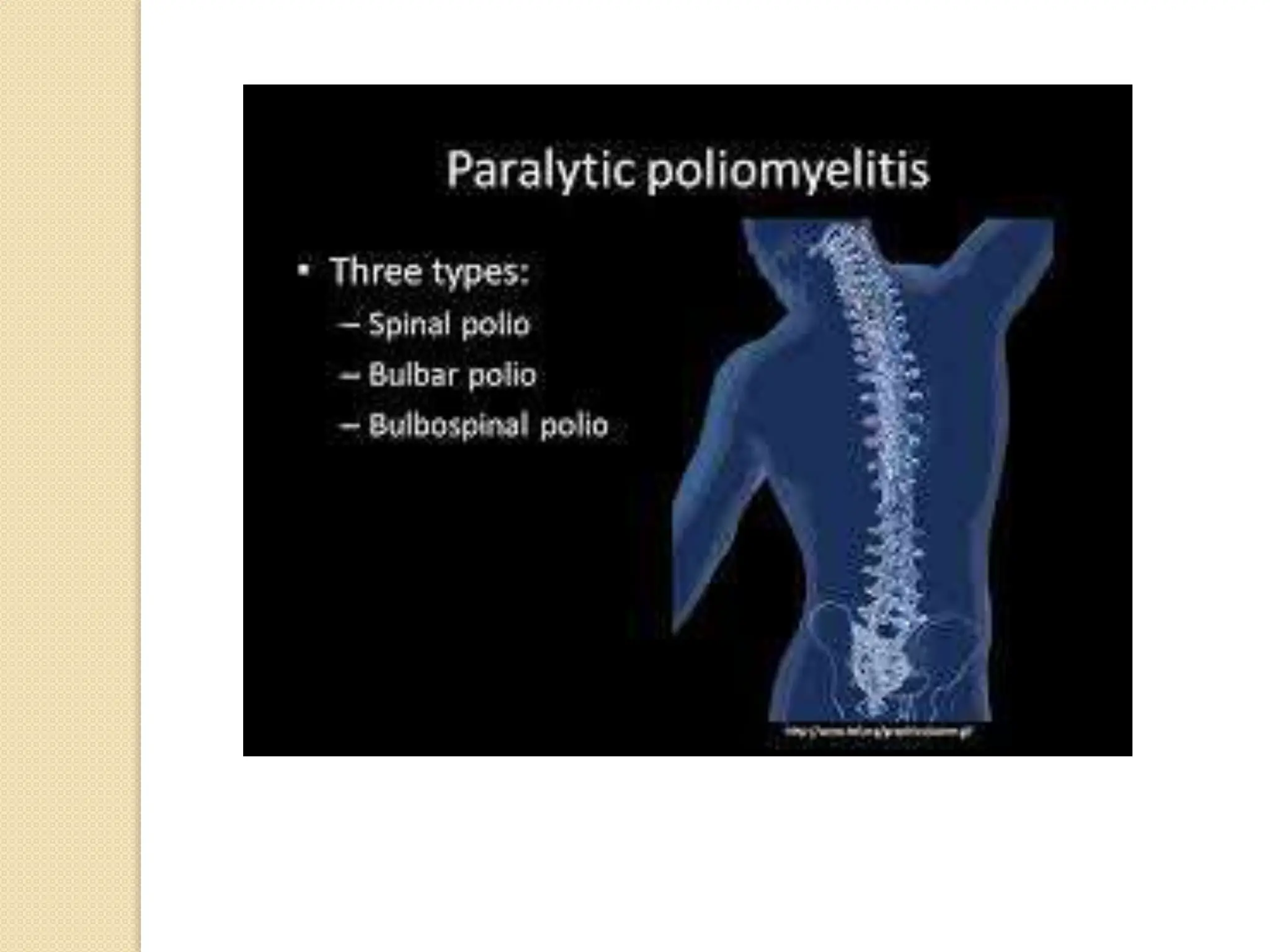Polio viruses and polio immunisation ppt by Dr Prince C P | PPTX
