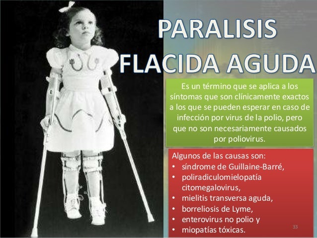 Poliomielitis y Parálisis flácida aguda