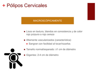 Pólipos Ginecológicos | PPTX