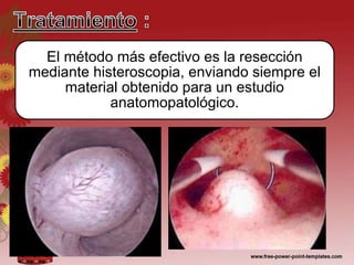 Polipos de cervix y endometriales | PPTX