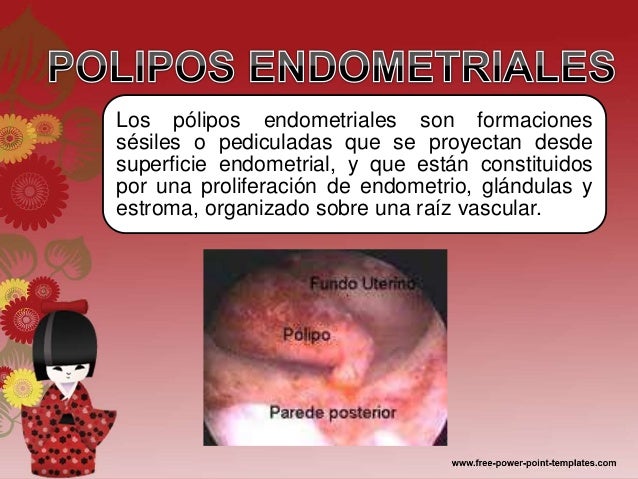 ¿Cuáles Son Los Síntomas De Los Pólipos Endocervicales – KVYOO