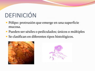 Polipos colorrectales | PDF