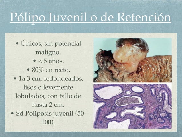 Pólipos de Colon y Recto | PPT