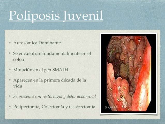 Pólipos de Colon y Recto