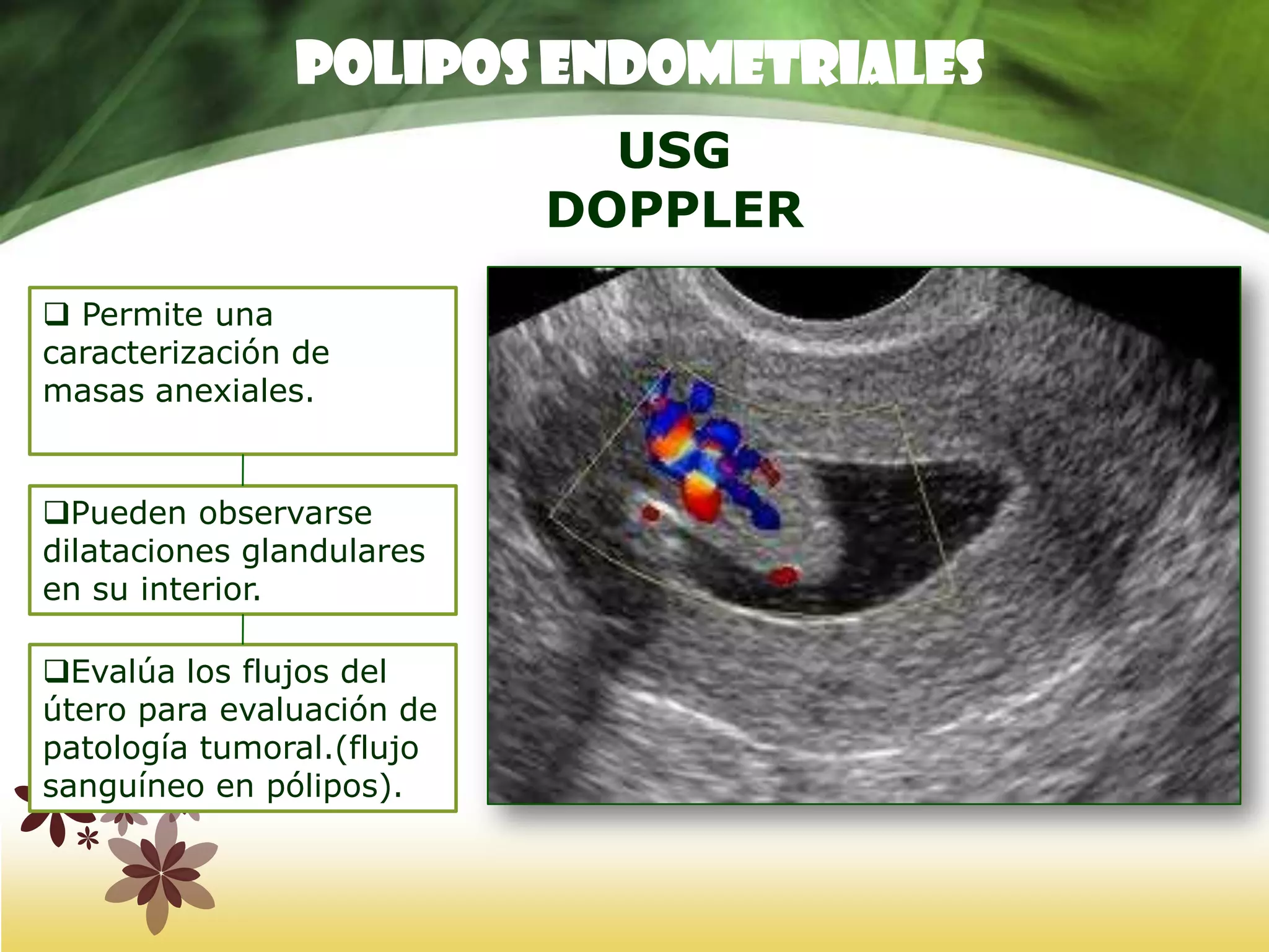 Polipos endometriales | PPT