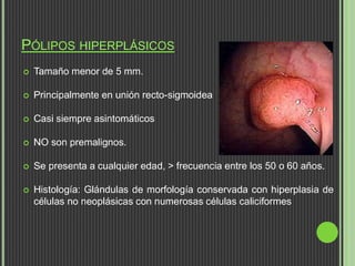 Poliposis intestinal | PPTX