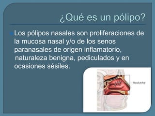 Histología De Los Pólipos Nasales