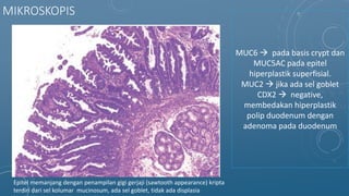 Polip pada Usus Halus.pptx
