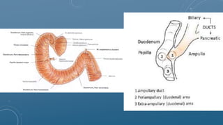 Polip pada Usus Halus.pptx