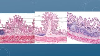 Polip pada Usus Halus.pptx