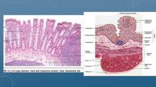 Polip pada Usus Halus.pptx