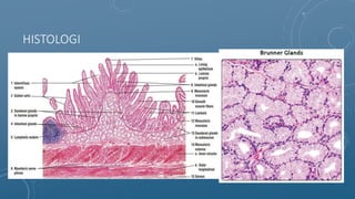 Polip pada Usus Halus.pptx