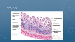 Polip pada Usus Halus.pptx