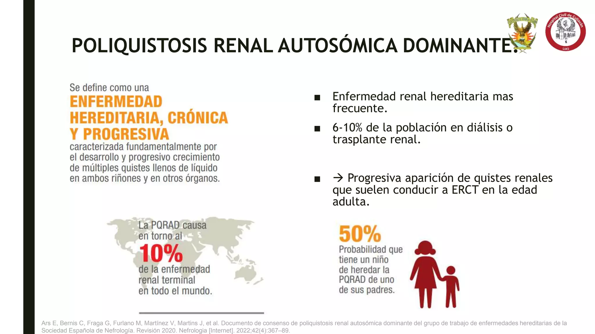 Poliquistosis Renal Pptx