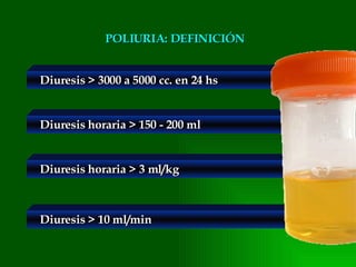 Diagnostico de las Poliurias | PPT