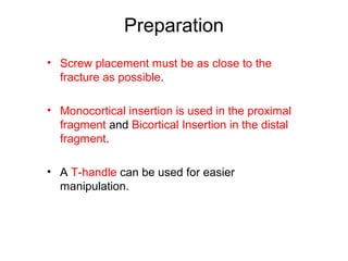 Poller or blocking screw | PPT