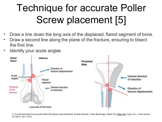 Poller or blocking screw