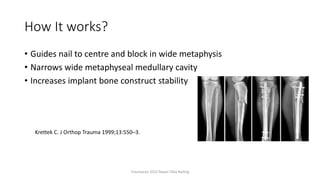 Poller screw Tibia.pptx