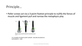 Poller screw Tibia.pptx