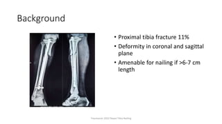 Poller screw Tibia.pptx