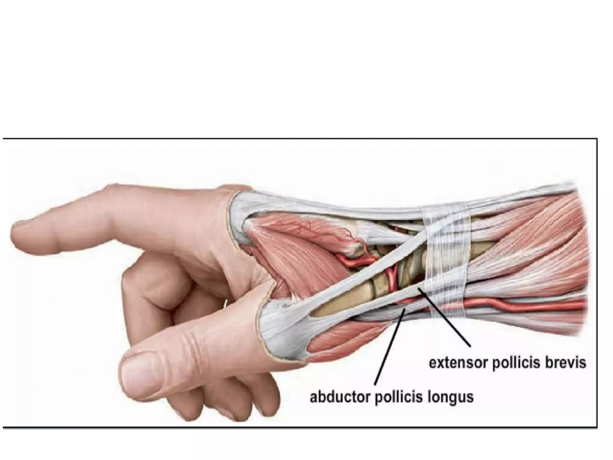 Pollicization | PPTX
