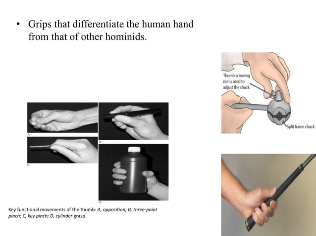 Pollicization | PPTX