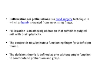 Pollicization | PPT