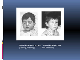 Pollution and the nervous system | PPT