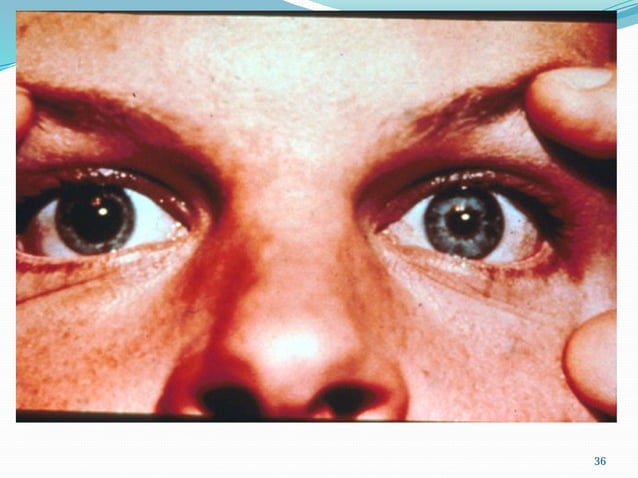 poly-trauma damage control orthopaedics DCO.pptx | First Aid | Injuries