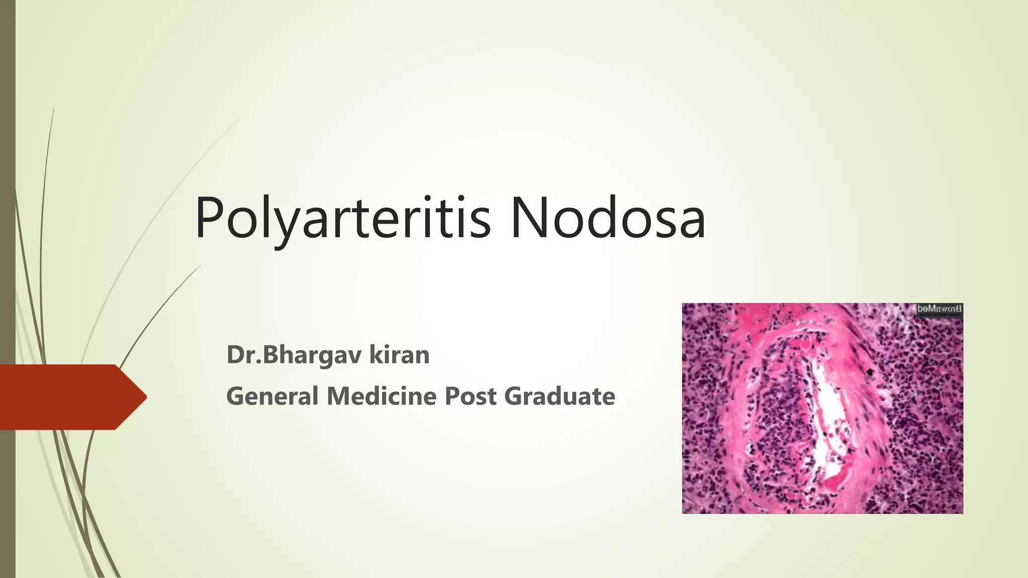 Polyarteritis nodosa | PPTX
