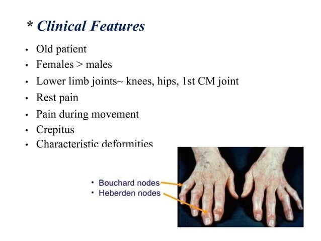 Polyarthritis (clinical approach) | PPTX | Bone and Joint Conditions ...