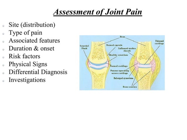 Polyarthritis (clinical approach) | PPTX | Bone and Joint Conditions ...