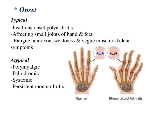Polyarthritis (clinical approach)