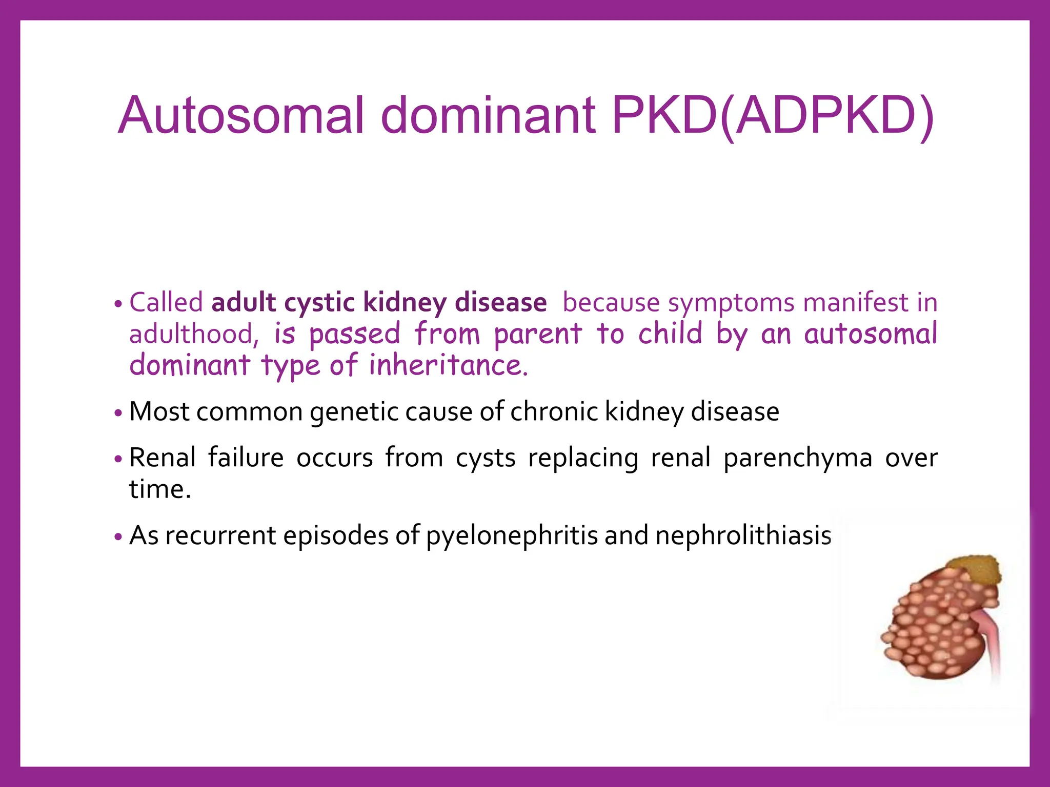 polycystic kidney.pptx