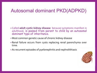 polycystic kidney.pptx