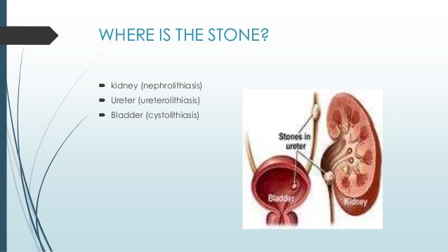 Polycystic kidney disease