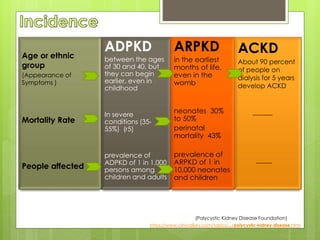 Polycystic kidney disease | PPTX