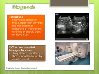 Polycystic kidney disease | PPTX