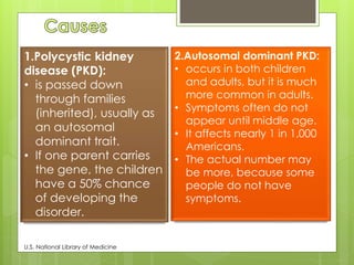 Polycystic kidney disease | PPTX