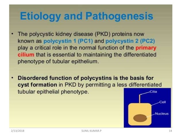 Poly cystic kidney disease | PPTX