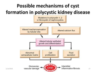 Poly cystic kidney disease | PPTX